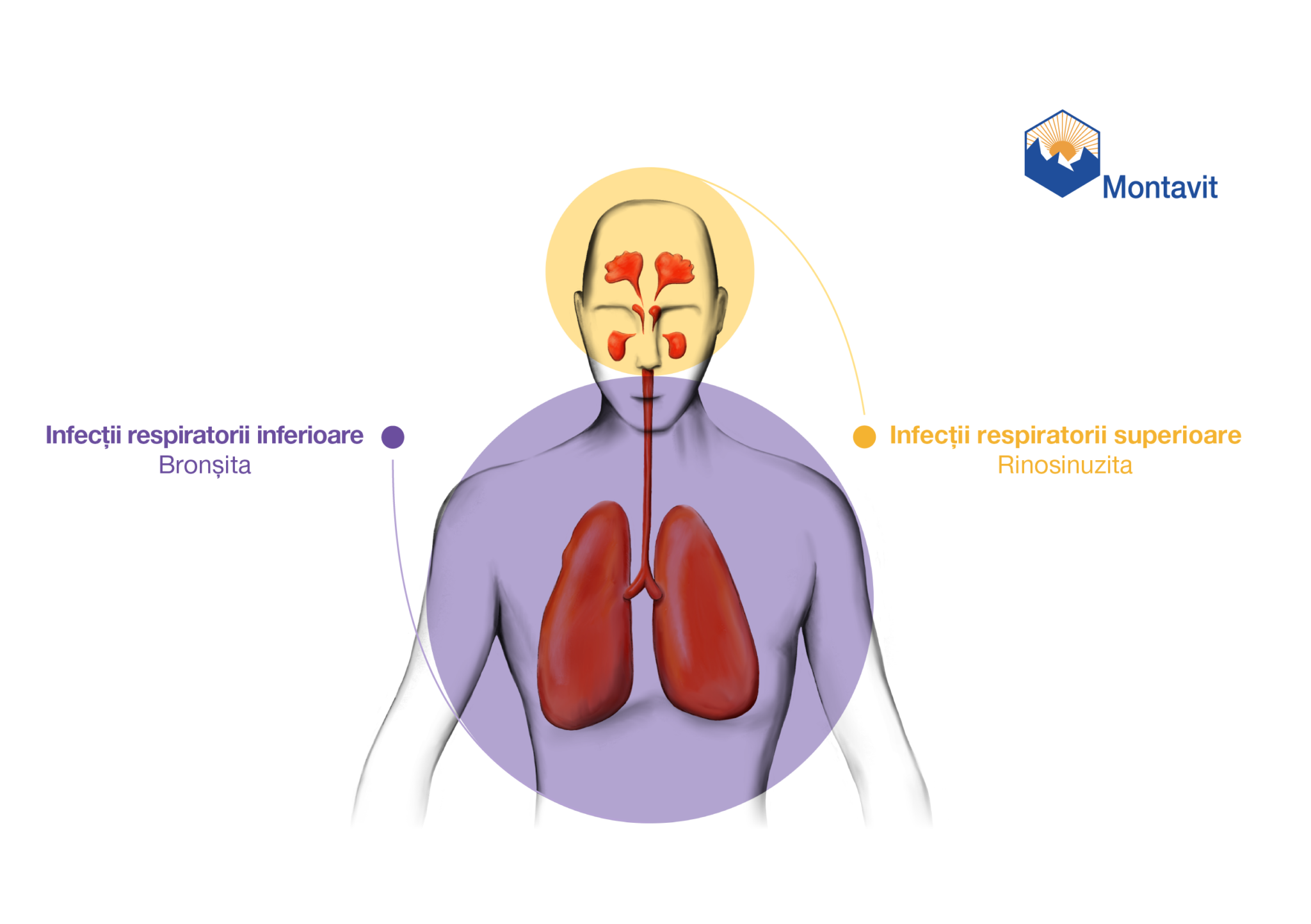 Tavipec Forte | Montavit